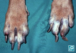 Onychodystrophy Isolated Nail Psoriasis: Delayed Diagnosis Raises PsA